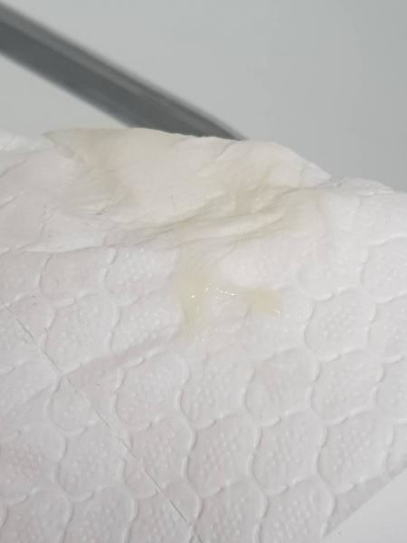 What is this type of discharge?