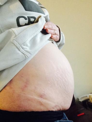 Baby bump at 12 weeks??