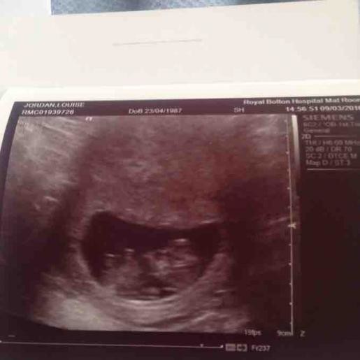 Scan at 9 weeks?