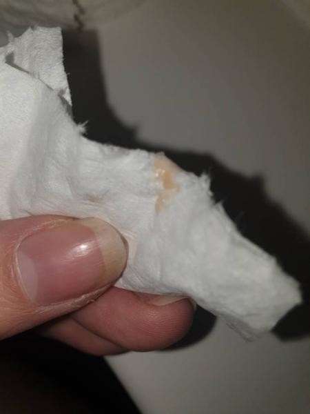 Weird discharge? Feeling sick? Help advice? | Netmums