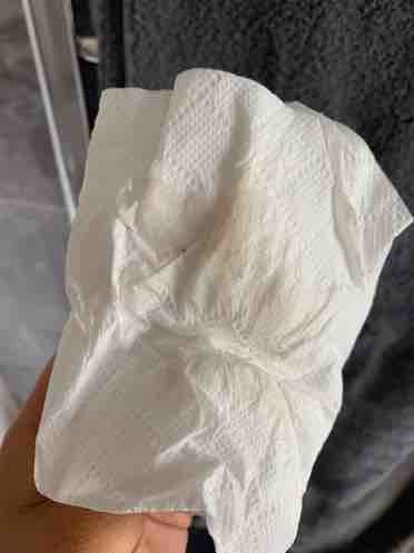 Implantation bleeding? 8 DPO