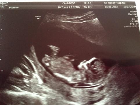 Nub theory....13 weeks, i think i know how about you????