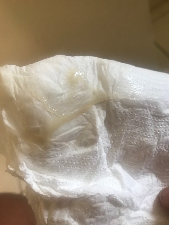 WARNING TMI OVULATION DISCHARGE OR IMPLANTATION DISCHARGE