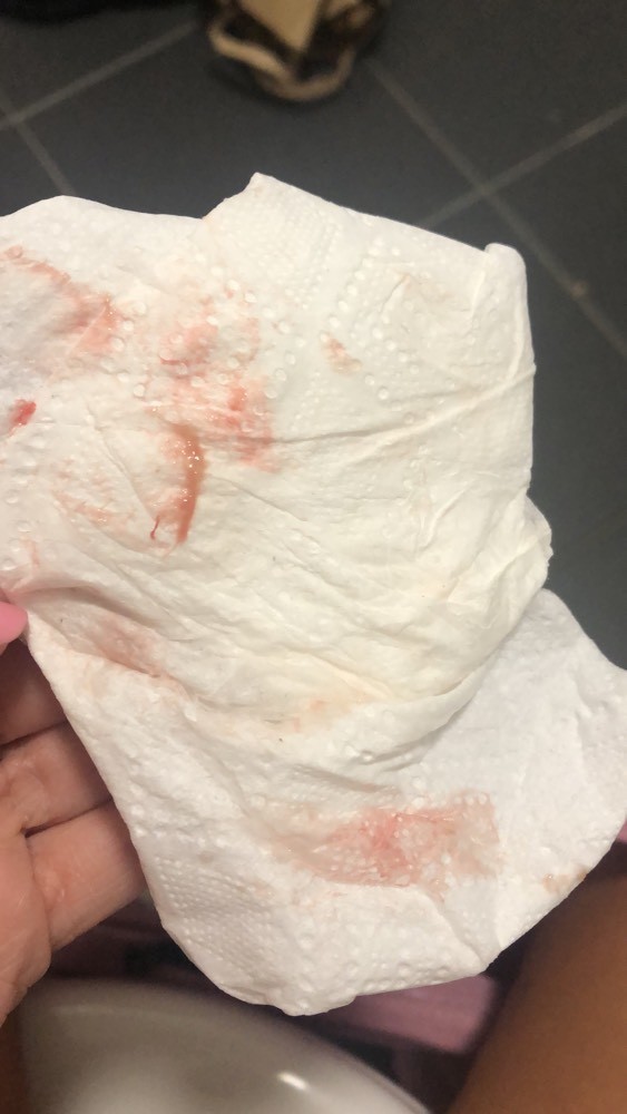 10dpo implantation bleeding?