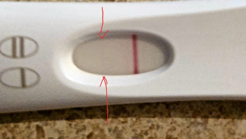 FRER Evap line?? | Netmums