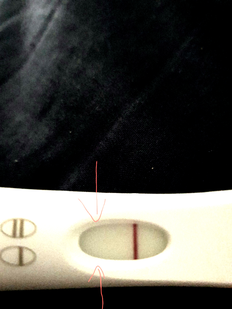 FRER Evap line?? | Netmums